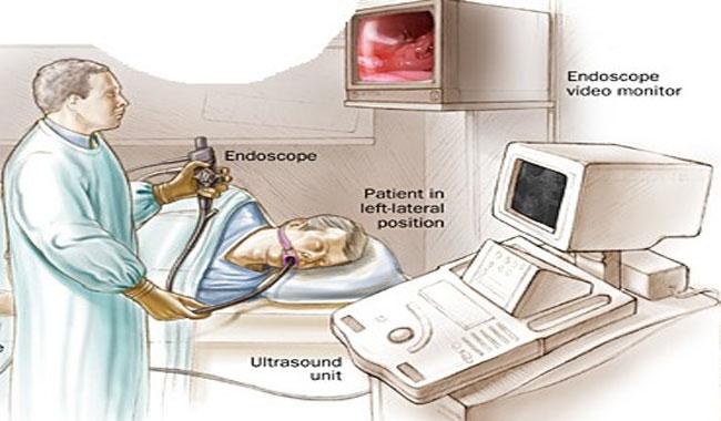 CLD workshop trains Endoscopic Ultrasound and Colonoscopy consultants