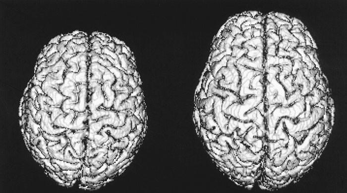 Indians have smallest brains in the world